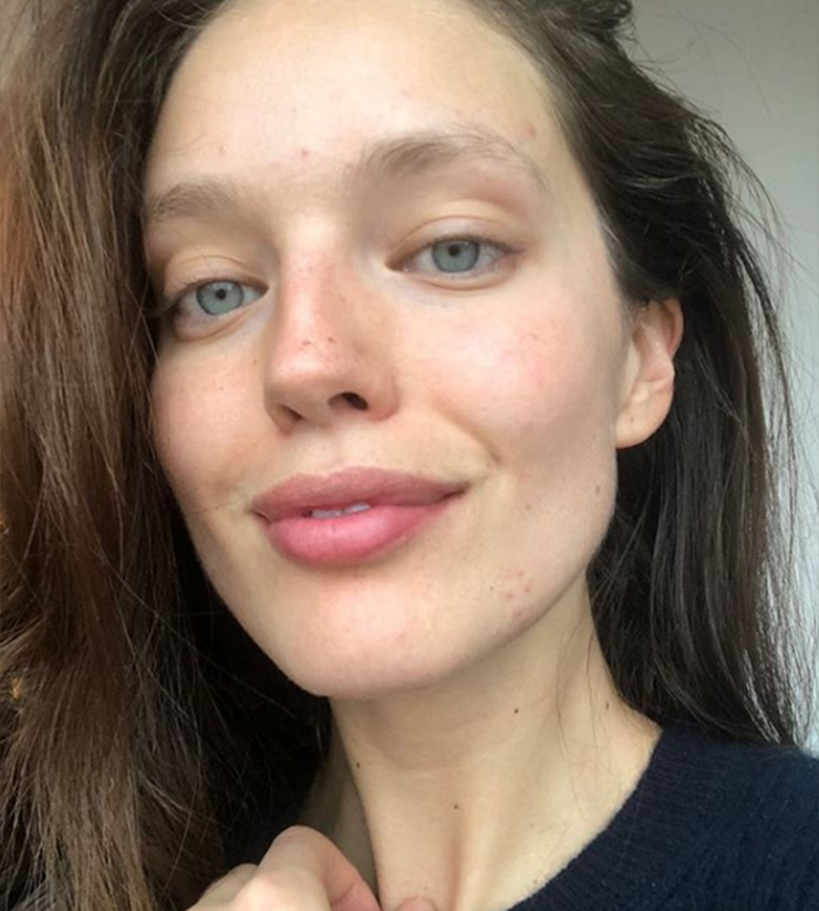 Как ускоряваме процеса на стареене на кожата | EVA.bg